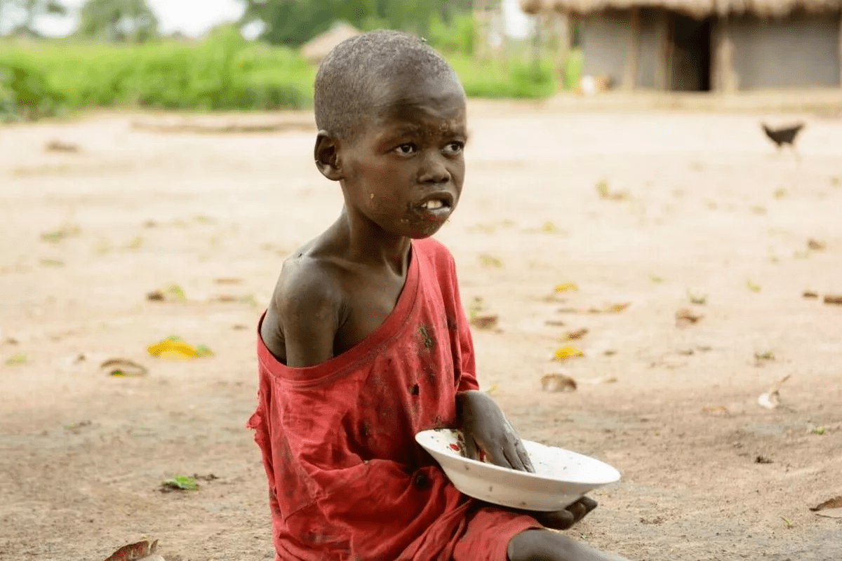 ‘Nodding syndrome’ that makes sufferers bob their head 20 times in 60 ...